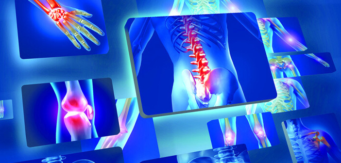 Arthrose erkennen und behandeln - MedMix