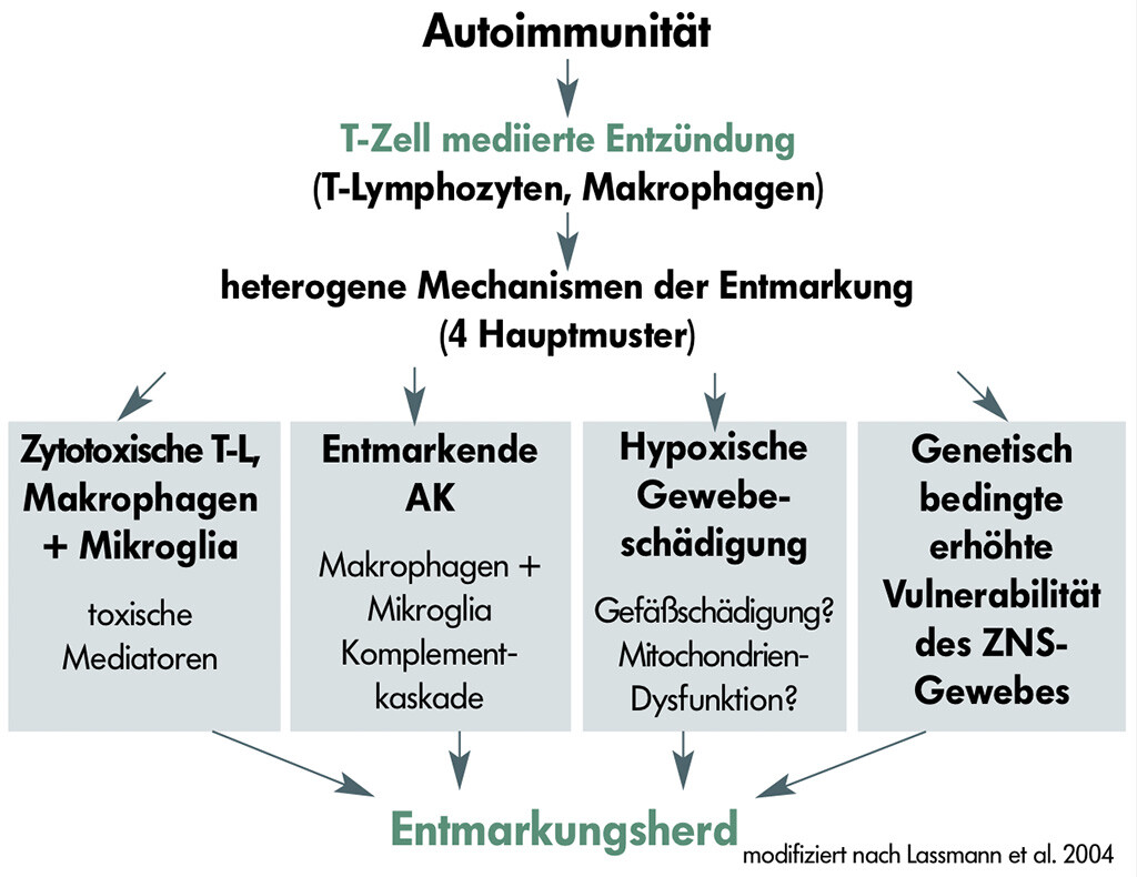 Entstehung der Multiplen Sklerose - MedMix