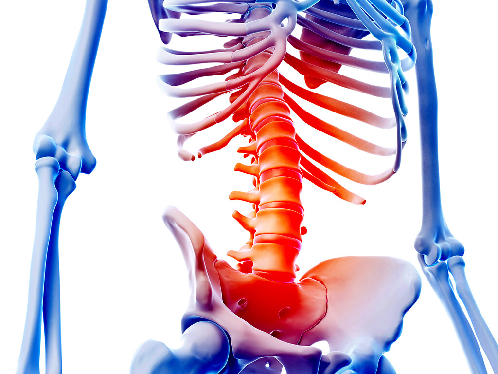 Was ist Morbus Bechterew ? - MedMix