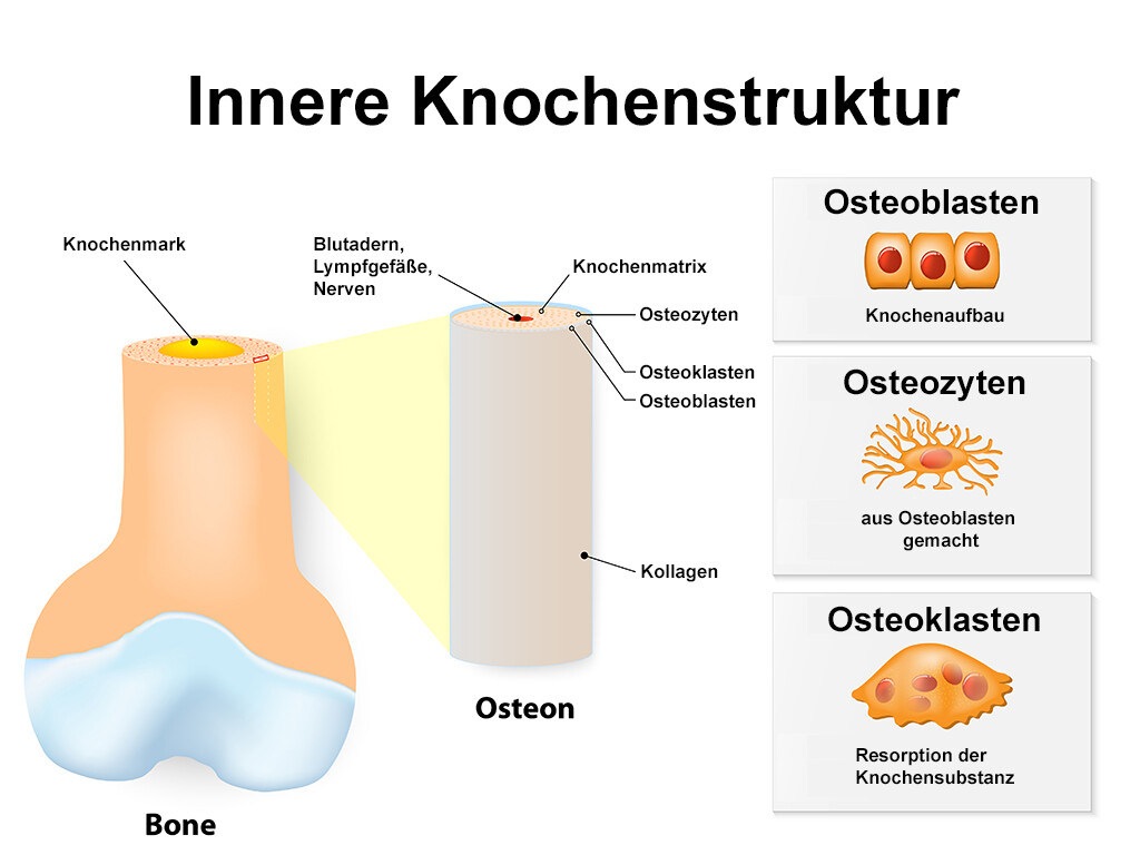 Normale und osteoporotische Knochen - MedMix