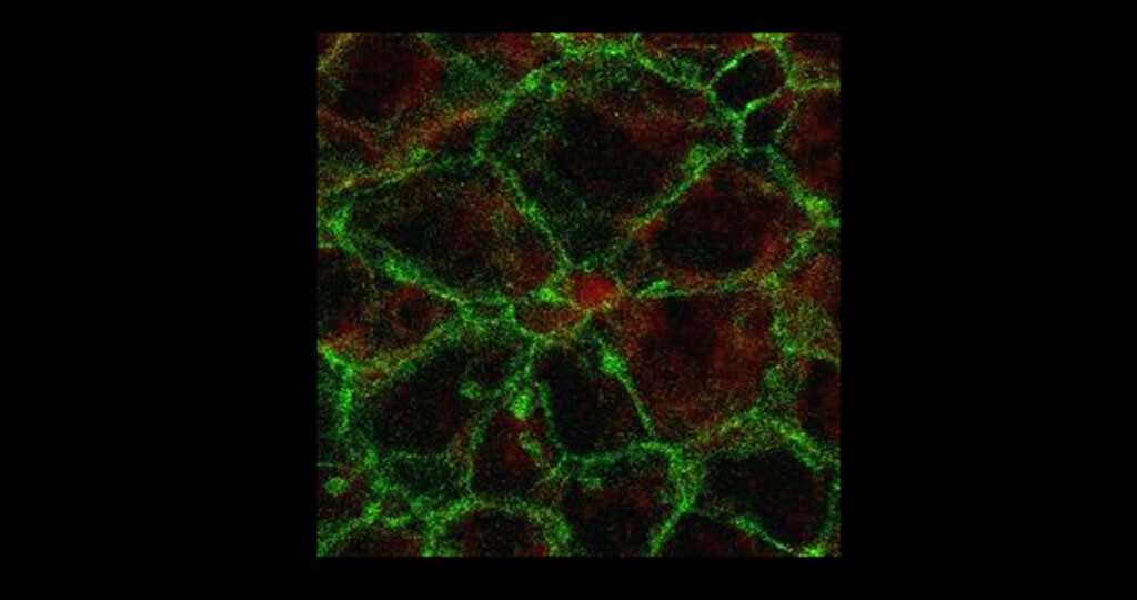ENaC und Stammzellen im Gehirn - MedMix