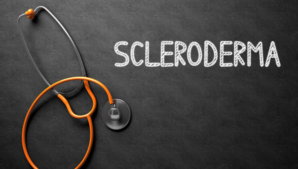Systemische Sklerose: viele Symptome schwer zu behandeln