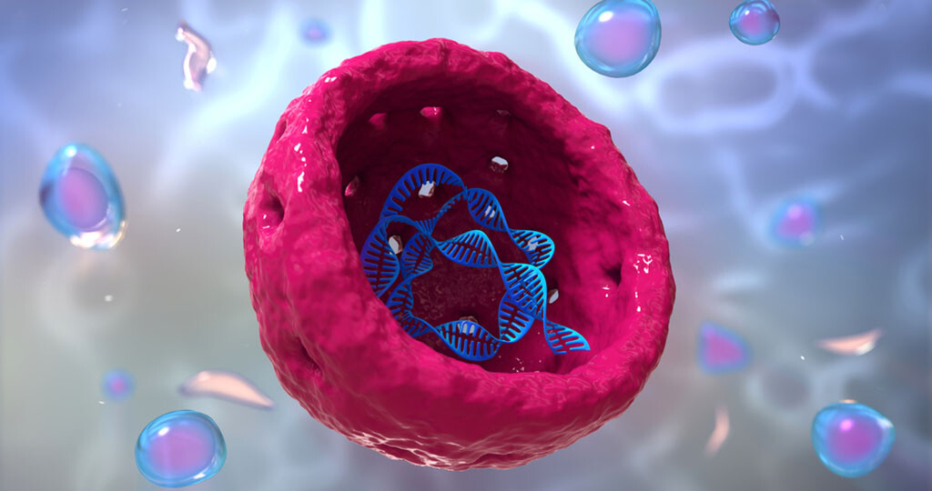 Nukleolus, das Kernkörperchen als Ort der Ribosomenproduktion - MedMix