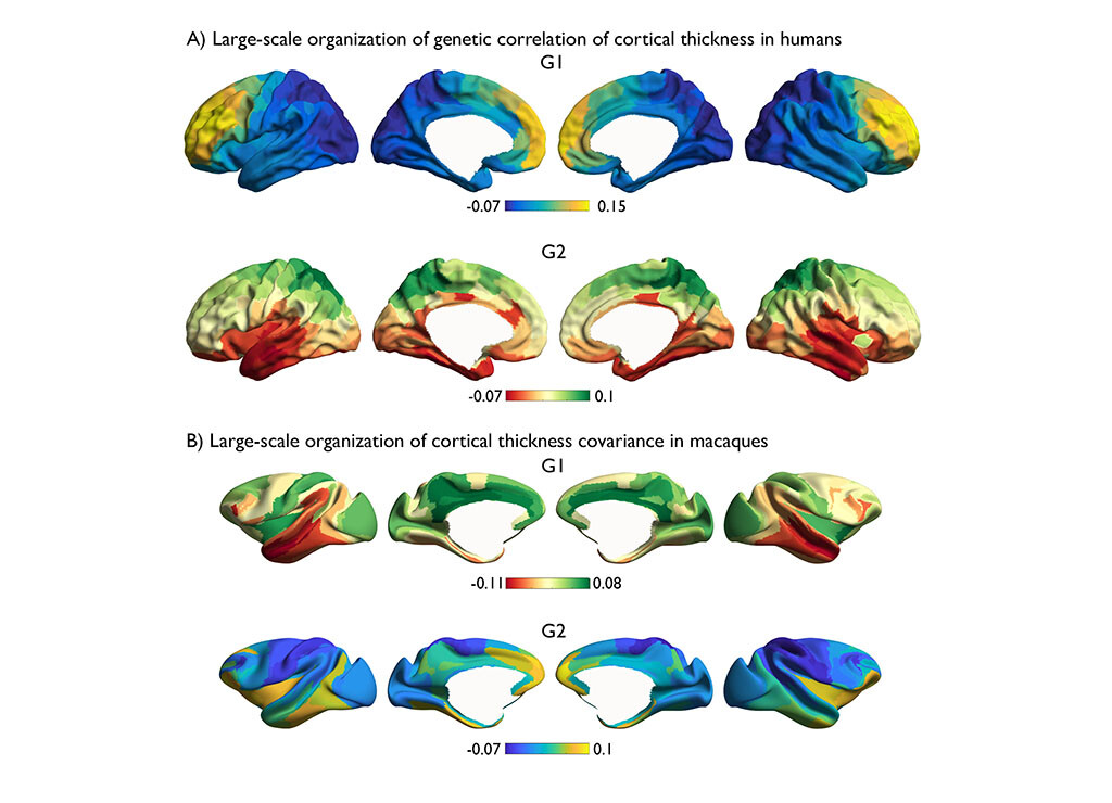 Evolutionäre und genetische Achsen: Einfluss auf Netzwerke im Gehirn